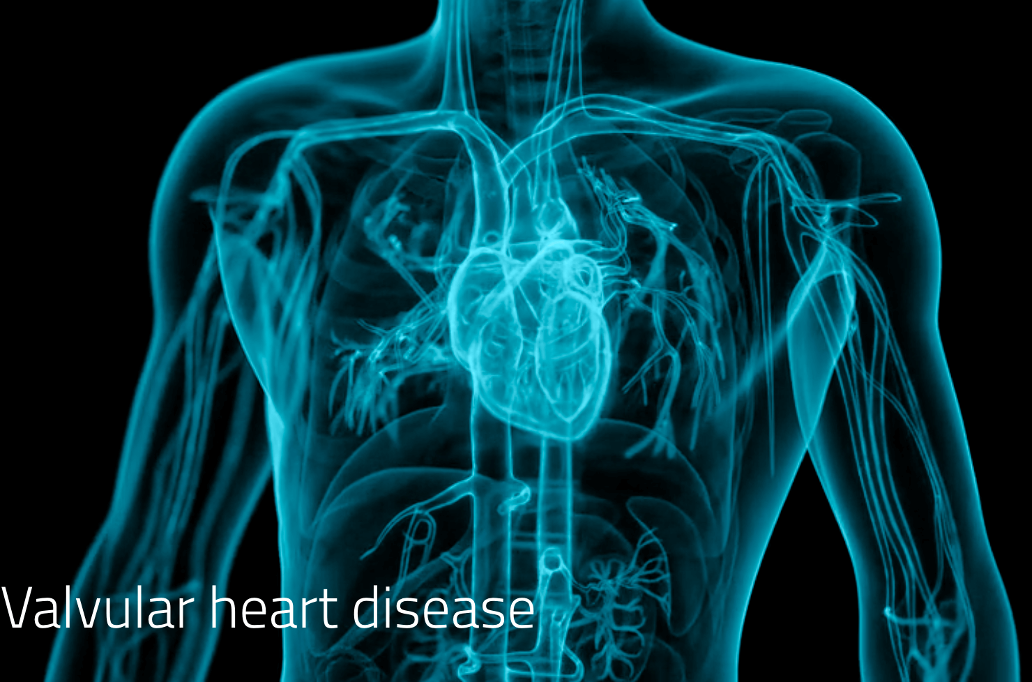 Valvular Heart Disease Clinical Research | SCIRENT Europe
